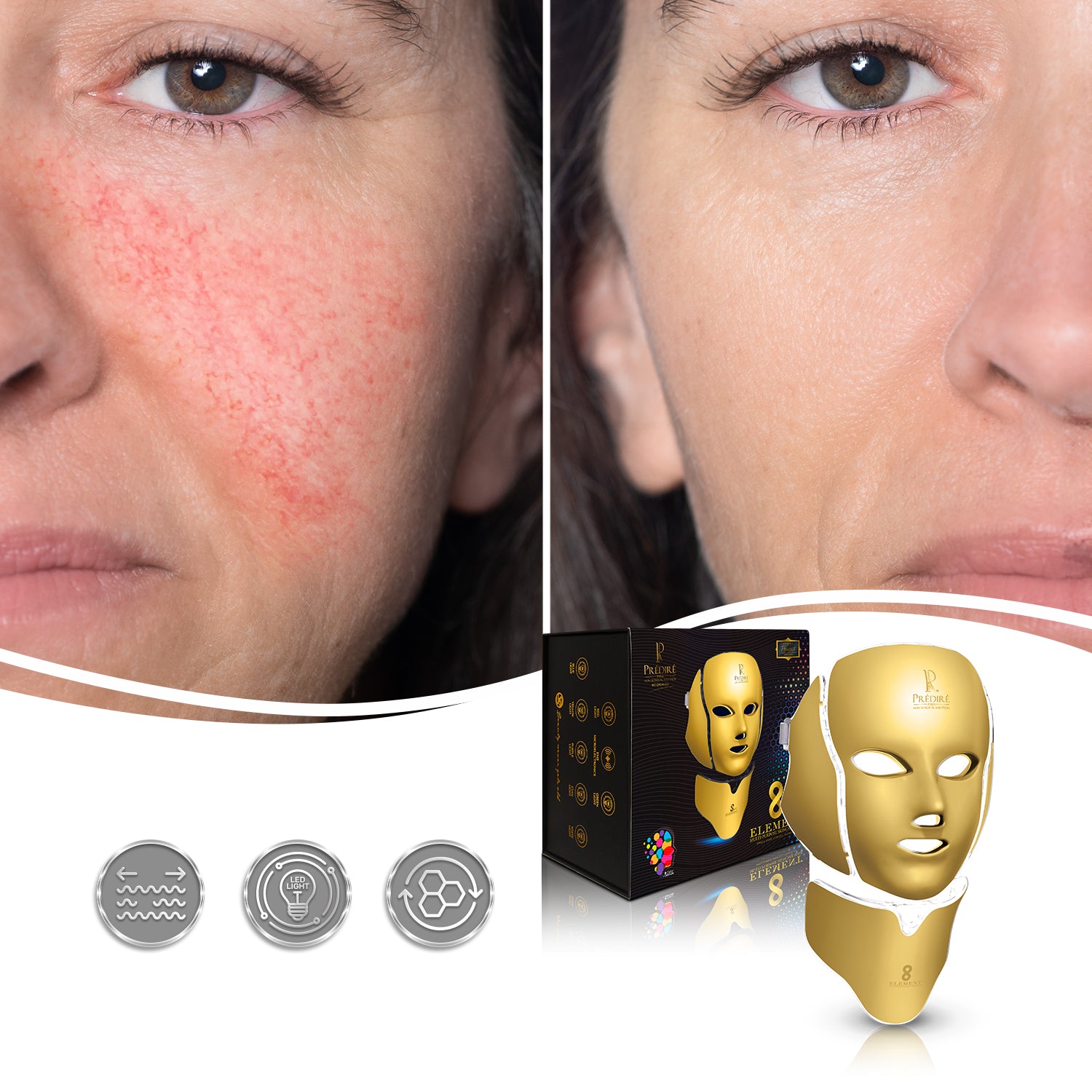 8 Element Multi-Purpose Skincare Mask (GOLD) | Non-Surgical Solution L ...