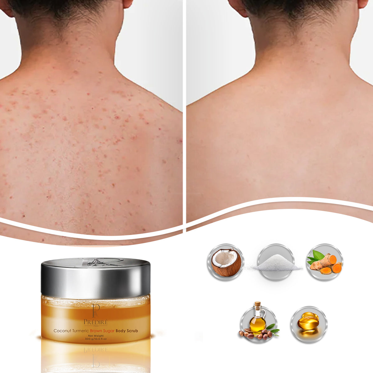 Coconut Turmeric Brown Sugar Body Scrub – Prédiré Paris