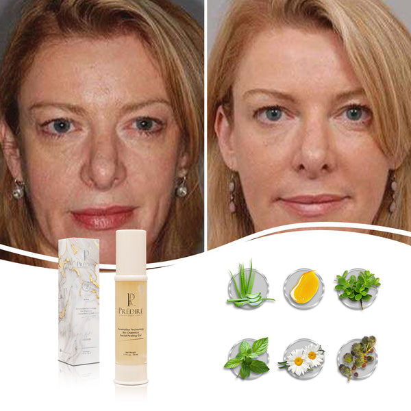 Bio Brightening Penetration Technology Bío-Organic Facial Peeling Gel ...