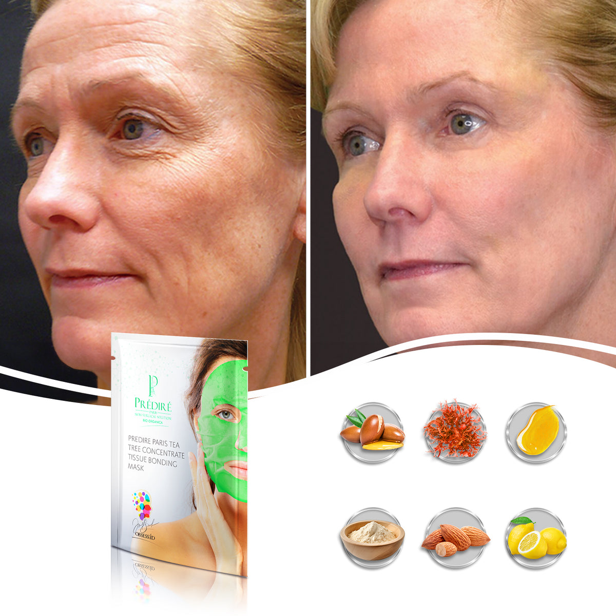 Predire Paris Tea Tree Concentrate Tissue Bonding Mask – Prédiré Paris