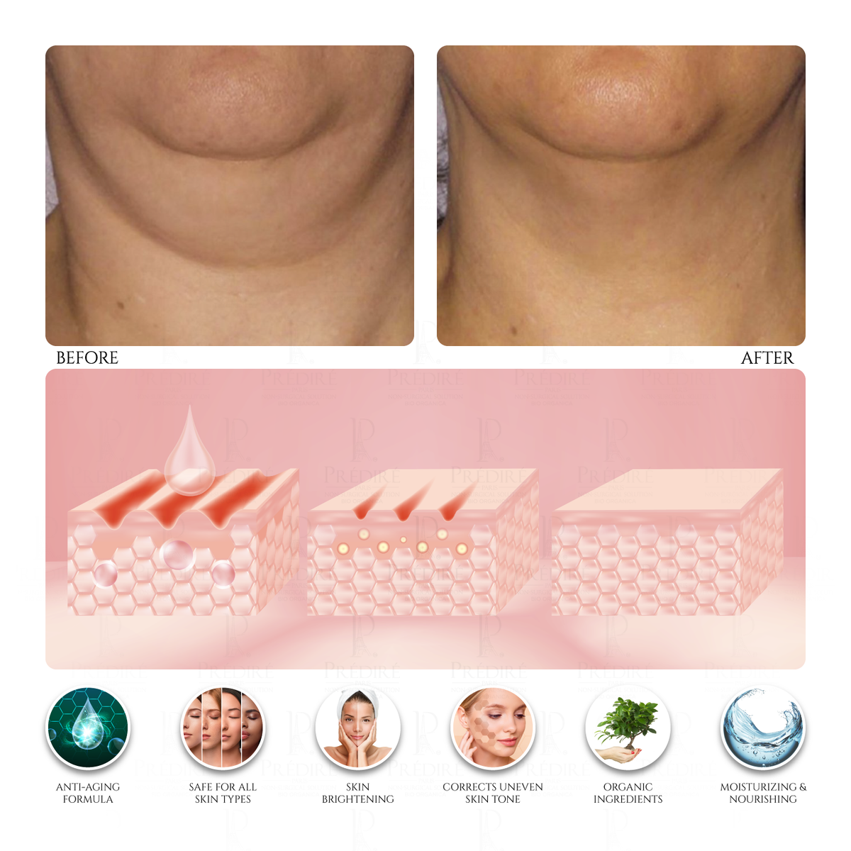 Red Wine Serum Face, Neck and Chest, 40 ml – Prédiré Paris