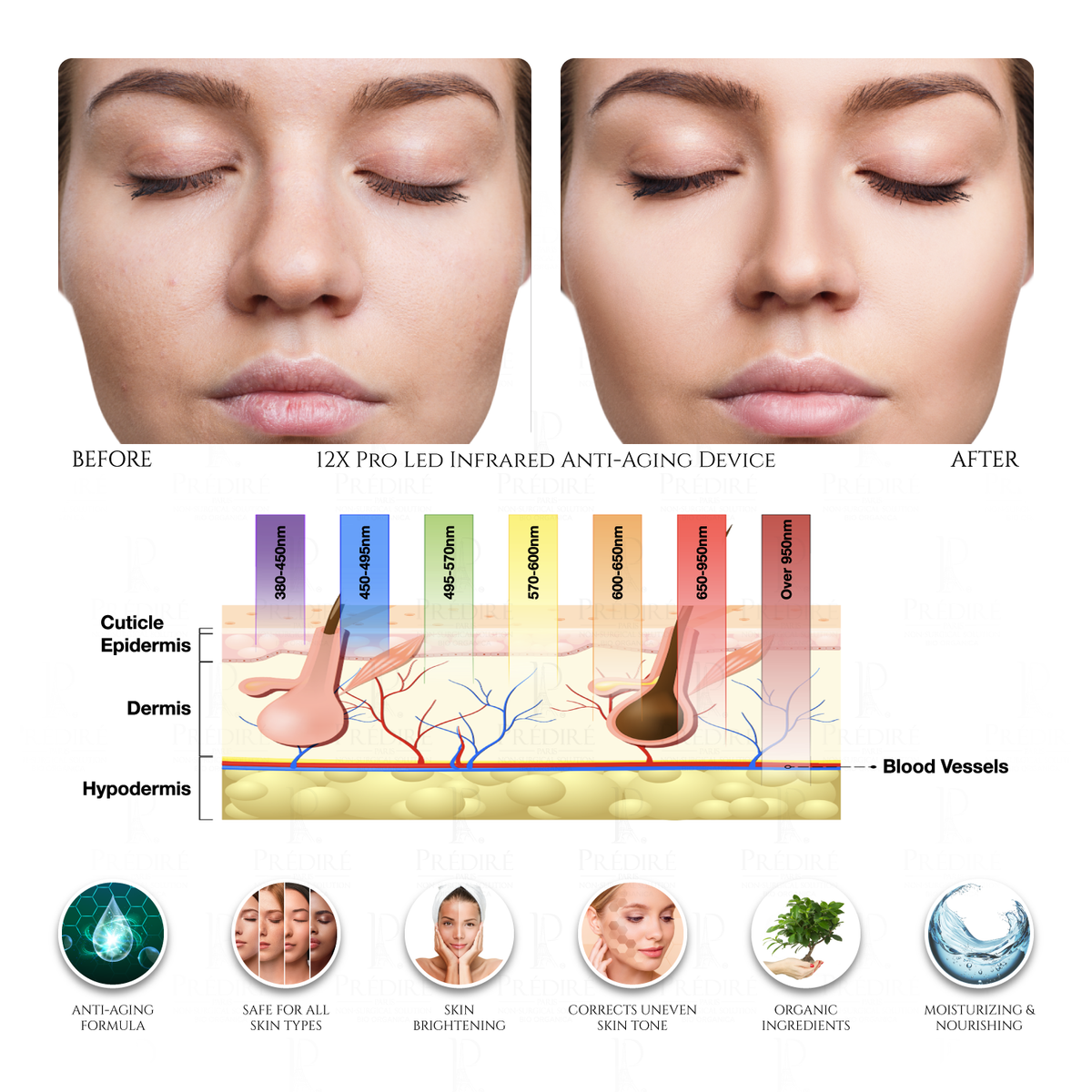 XTREME Skin Rejuvenation Device | Hot & Cold LED Light Therapy Anti-Ag ...